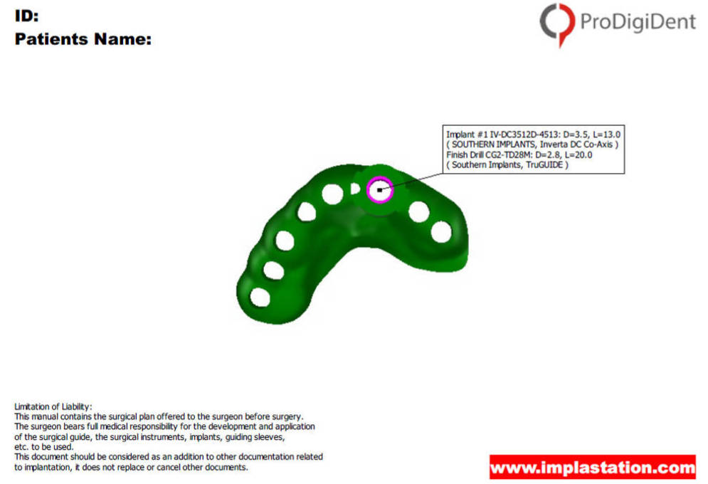 3D planning of Southern Implants INVERTA Co-Axis immediate implant ...